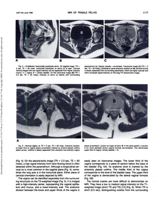 MRI of the Female Pelvis | PDF