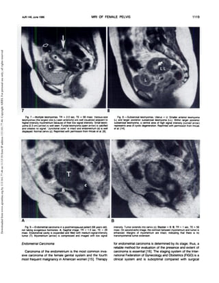 MRI of the Female Pelvis | PDF