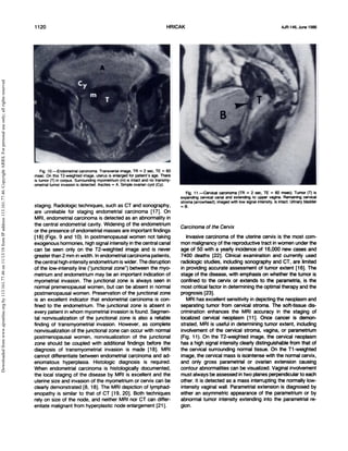 MRI of the Female Pelvis | PDF