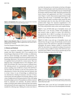 Technic and Results of Circumcision in Patients With Haemophilia at the ...
