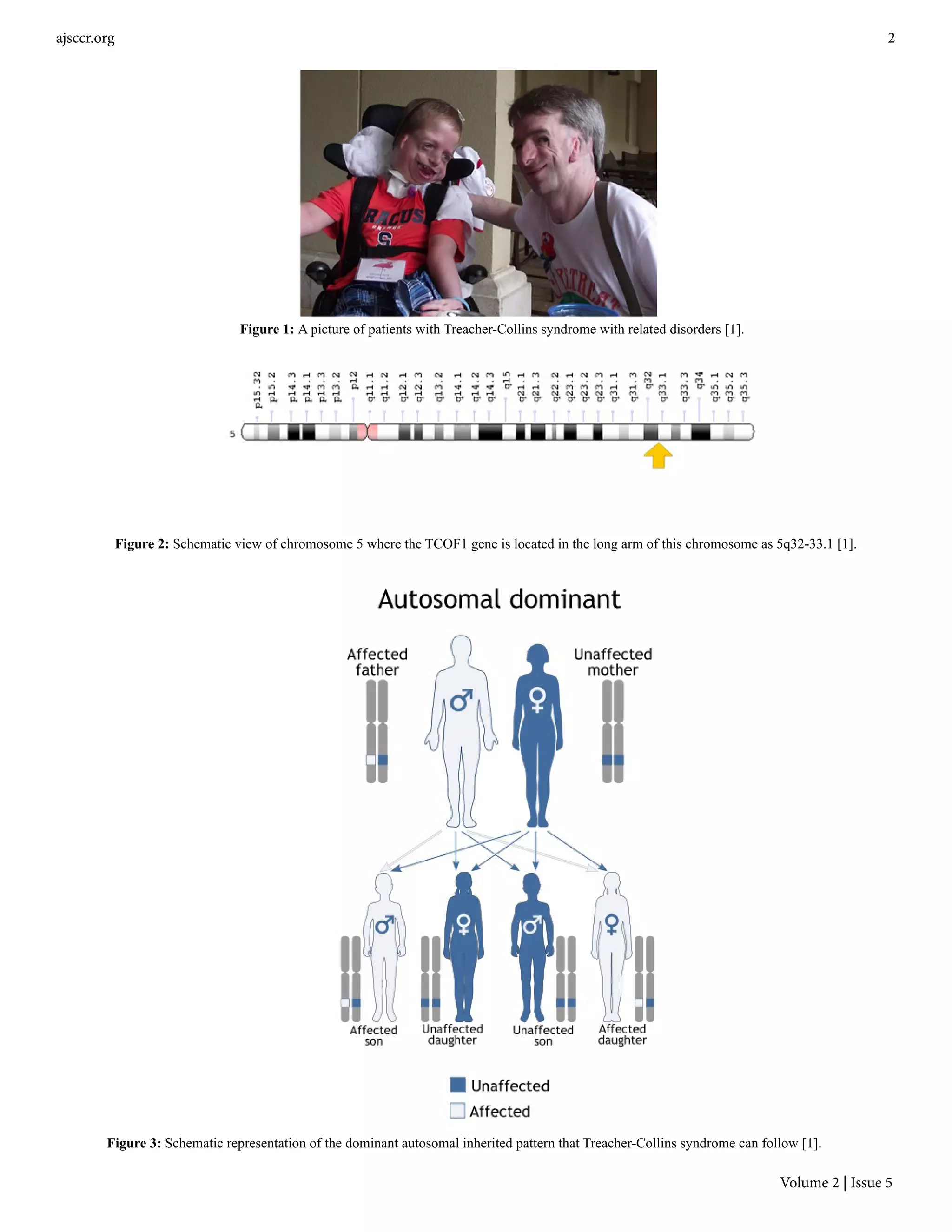 The Role of Mutations on Gene TCOF1, in Treacher Collins Syndrome | PDF