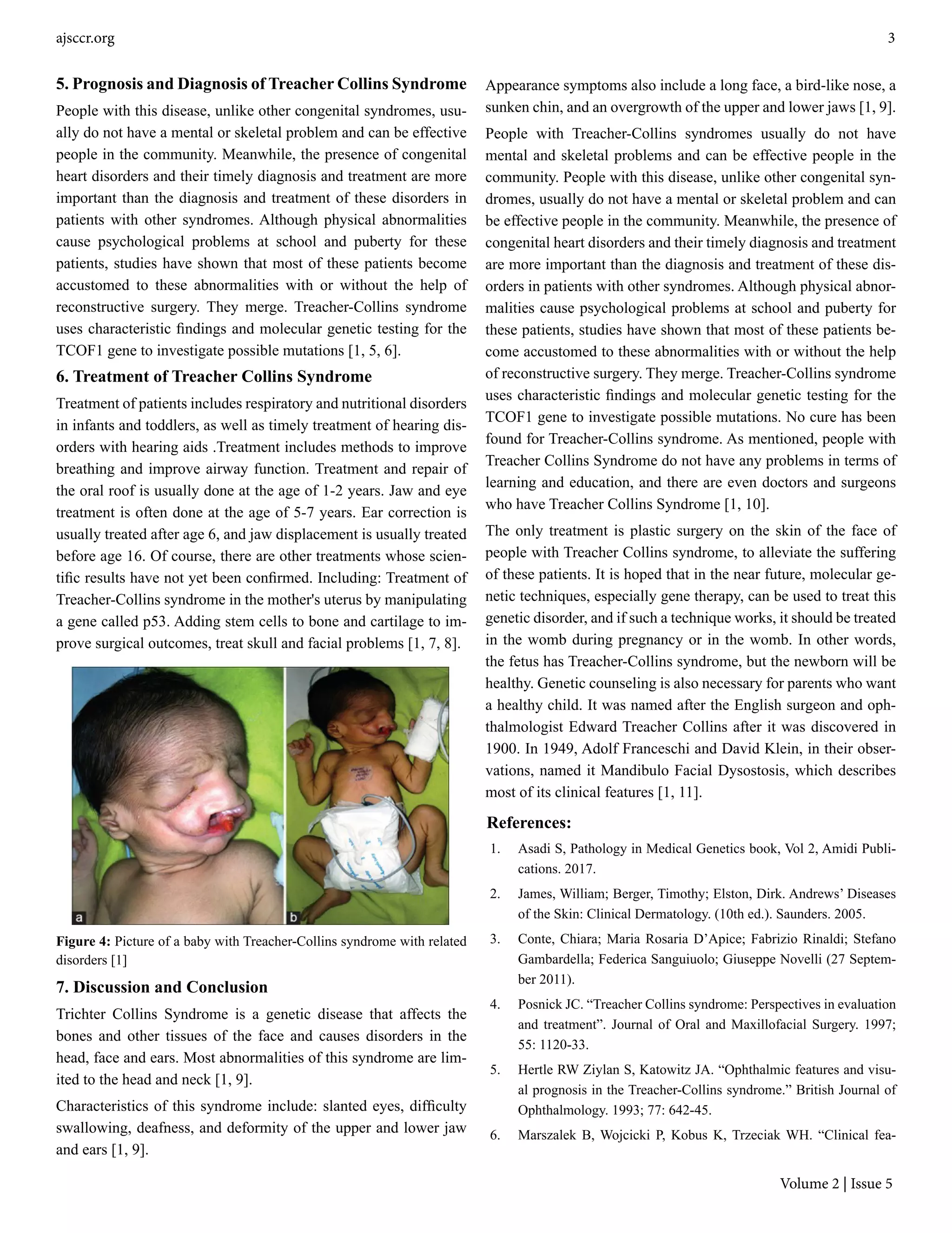 The Role of Mutations on Gene TCOF1, in Treacher Collins Syndrome | PDF