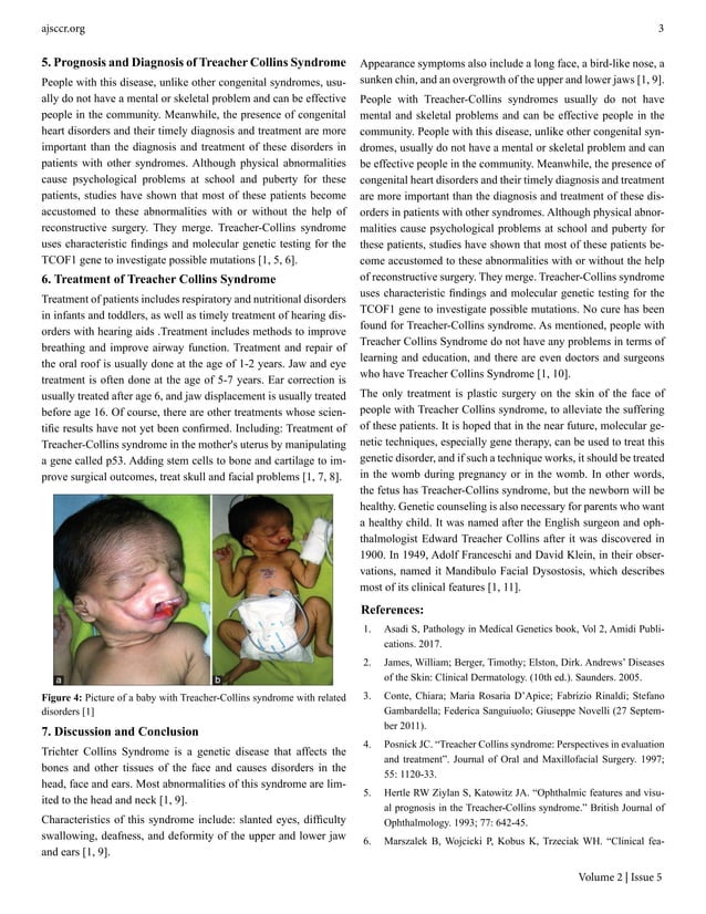 The Role of Mutations on Gene TCOF1, in Treacher Collins Syndrome | PDF