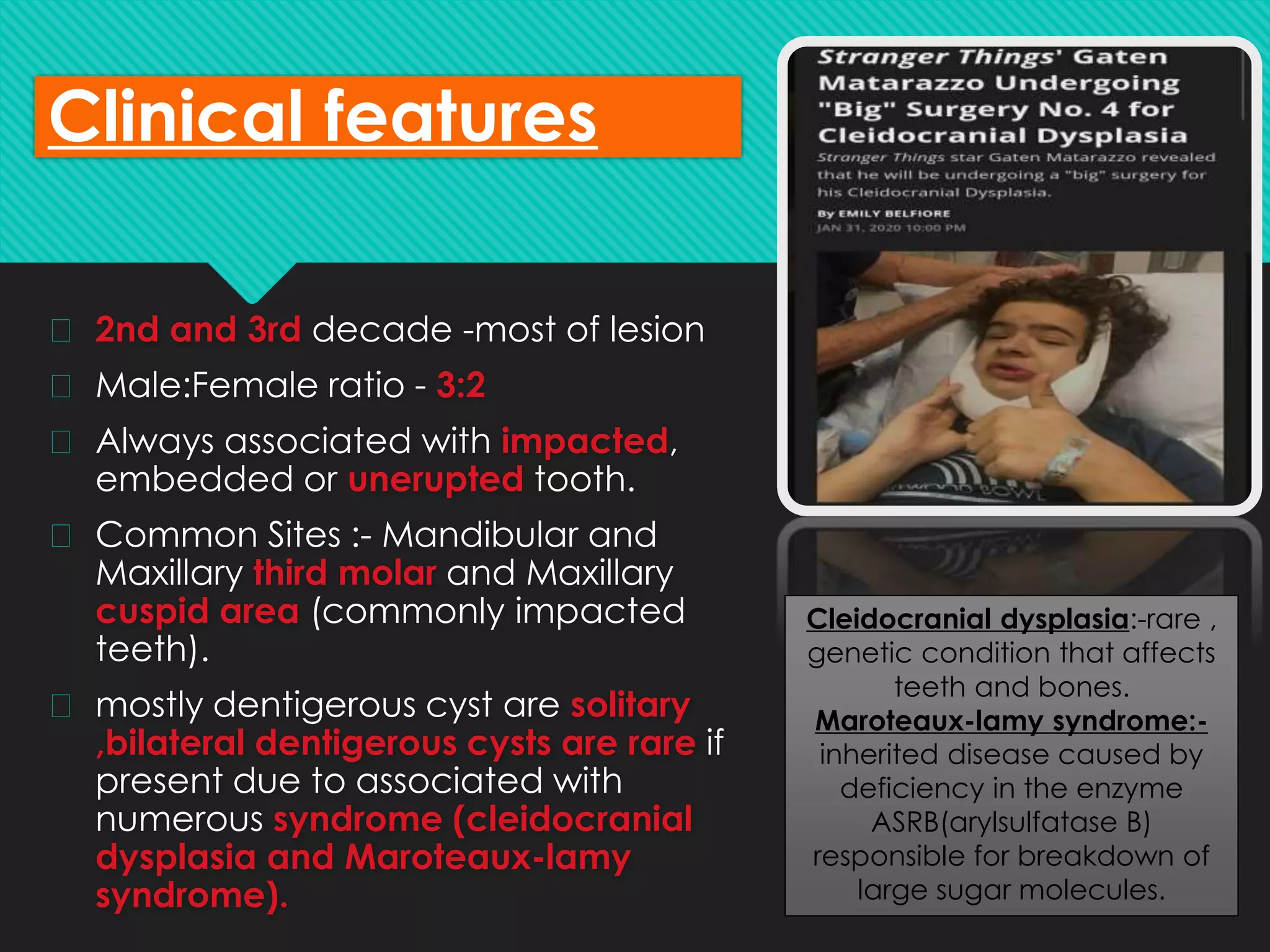 DENTIGEROUS CYST & CALCIFYING ODONTOGENIC CYST.pptx