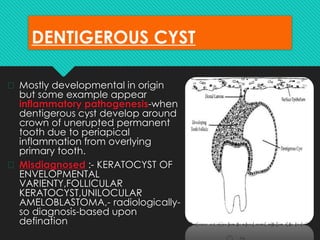 DENTIGEROUS CYST & CALCIFYING ODONTOGENIC CYST.pptx