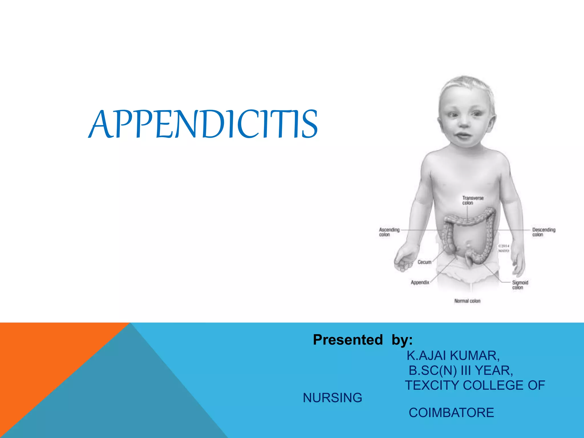 Appendicitis overview | PPTX