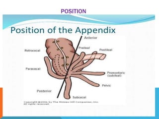 Appendicitis overview | PPTX