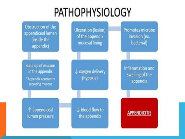 Appendicitis overview | PPTX