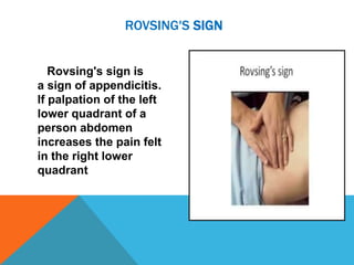 Appendicitis overview | PPTX