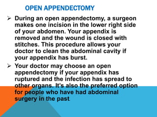 Appendicitis overview | PPTX