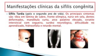 Aula 3 -_doencas_infecciosas | PPTX
