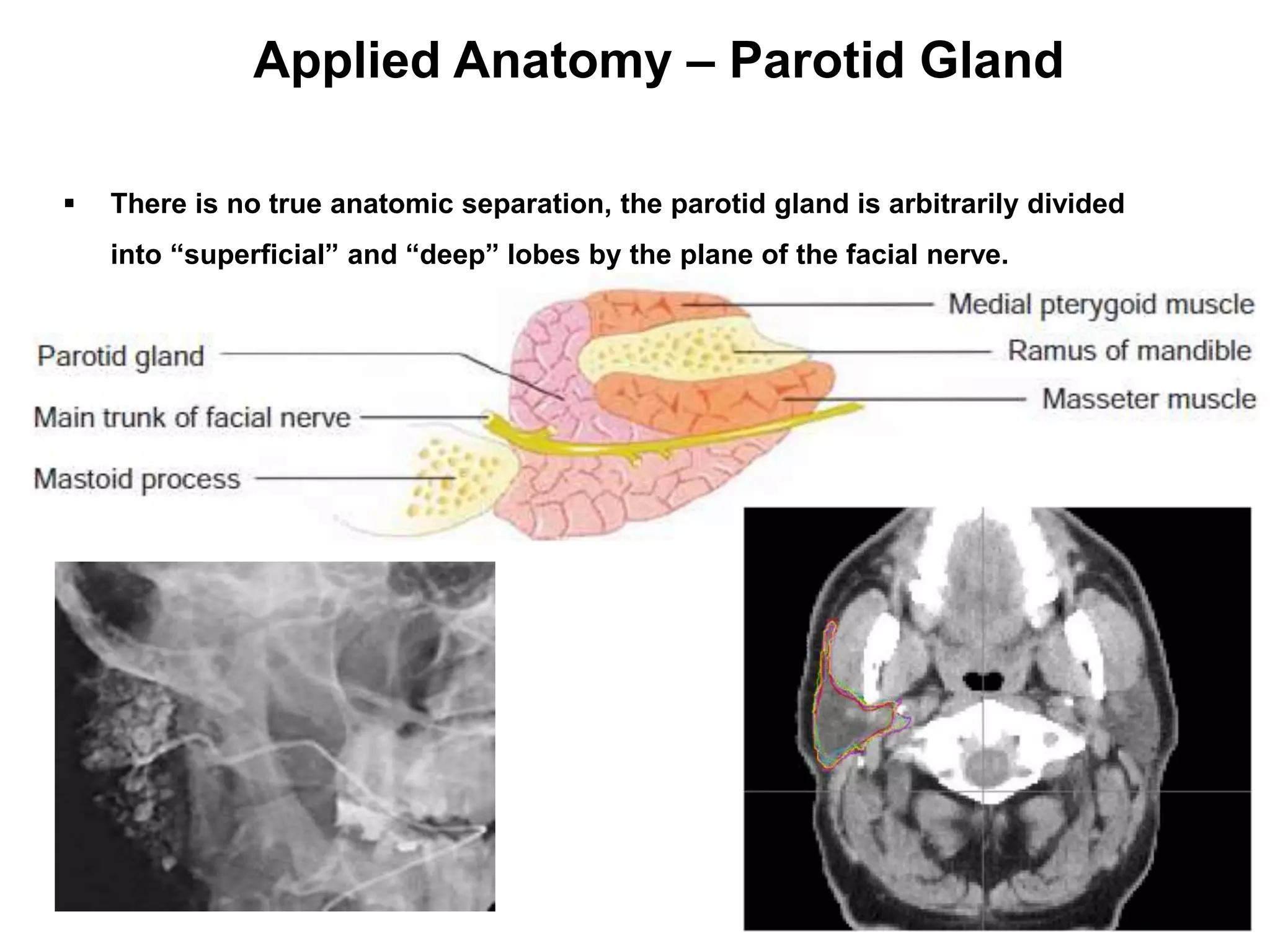 Salivary gland tumours | PPTX