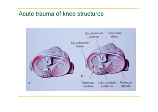 Lower limb ... Region of the lower limb, the gluteal region | PDF