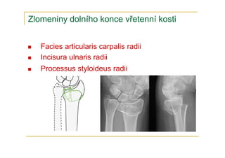 Lower limb ... Region of the lower limb, the gluteal region | PDF