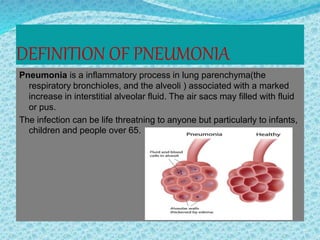 Pneumonia and it's management | PPT