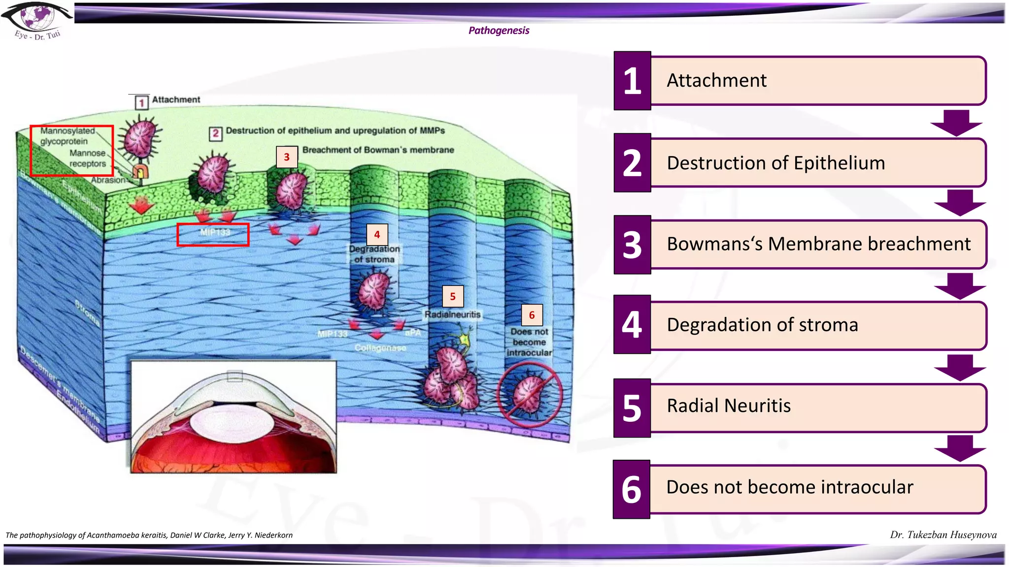 Akanthomoeba Keratitis.pdf