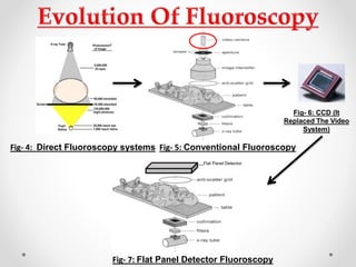 Flat Panel Digital Fluoroscopy by Akash Das | PPT