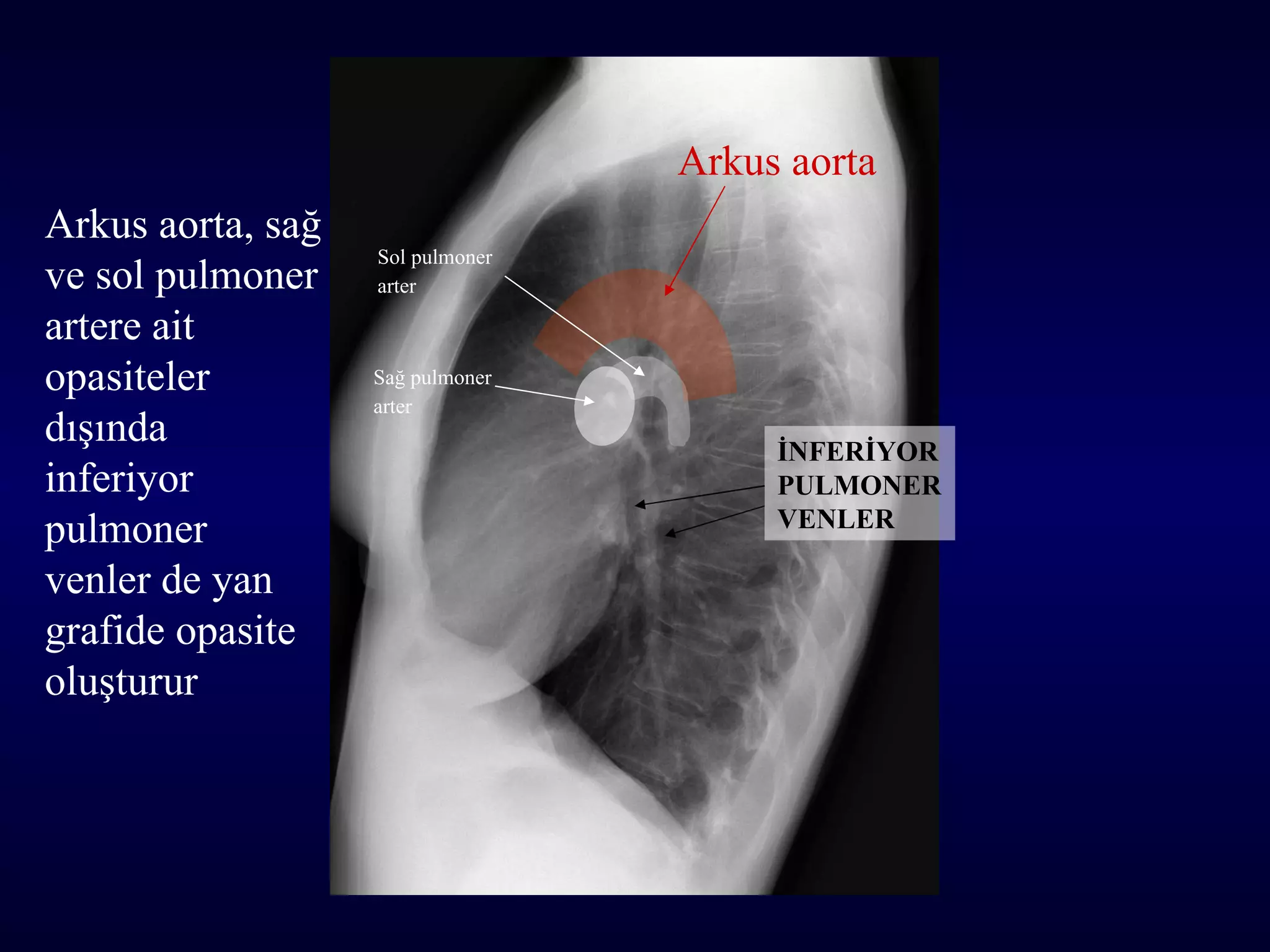 Akciğer grafisi (fazlası için www.tipfakultesi.org) | PPT