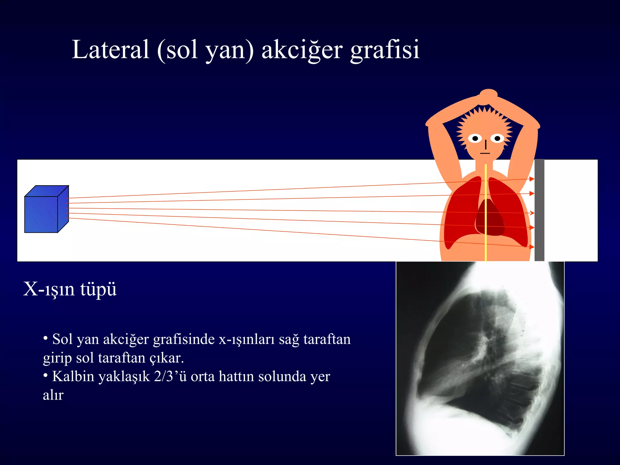 Akciğer grafisi (fazlası için www.tipfakultesi.org) | PPT