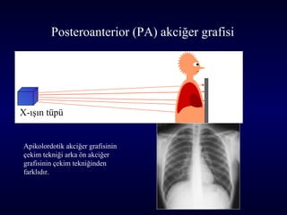 Akciğer grafisi (fazlası için www.tipfakultesi.org) | PPT