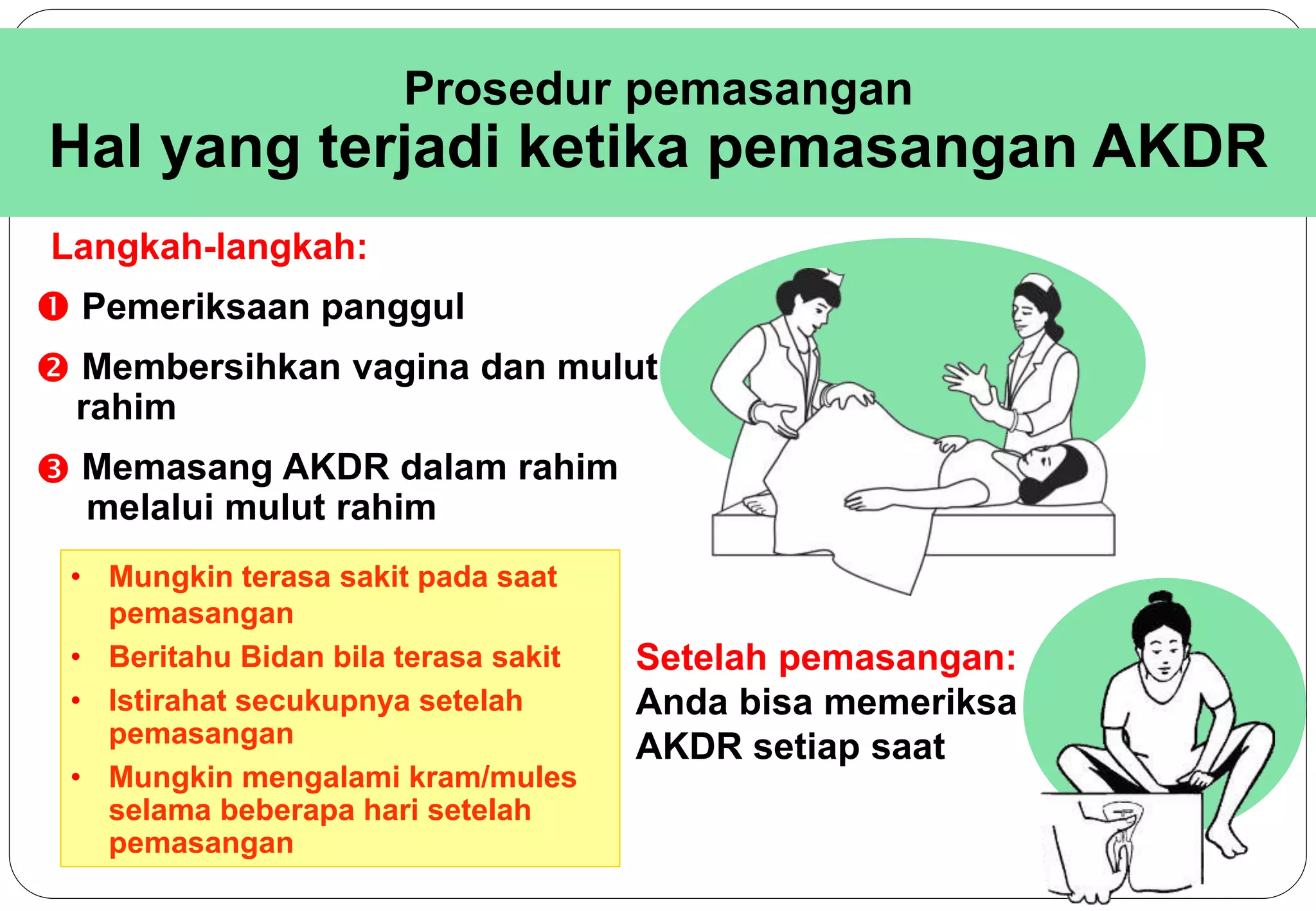 Alat Kontrasepsi Dalam Rahim (AKDR) | PPT