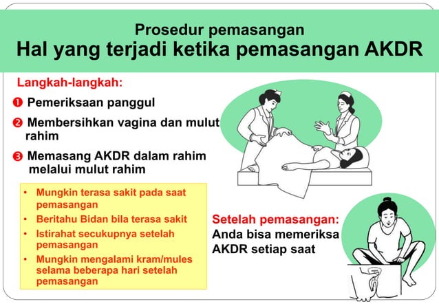Alat Kontrasepsi Dalam Rahim (AKDR) | PPT
