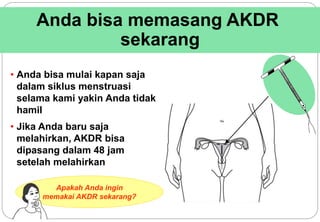 Alat Kontrasepsi Dalam Rahim (AKDR) | PPT