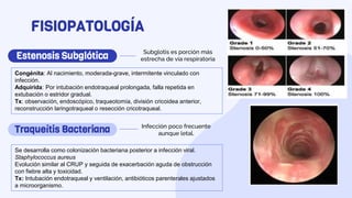 Estridor_en_ninos.pptx
