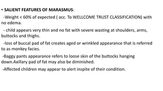 Severe acute malnutrition presentation ppt | PPTX