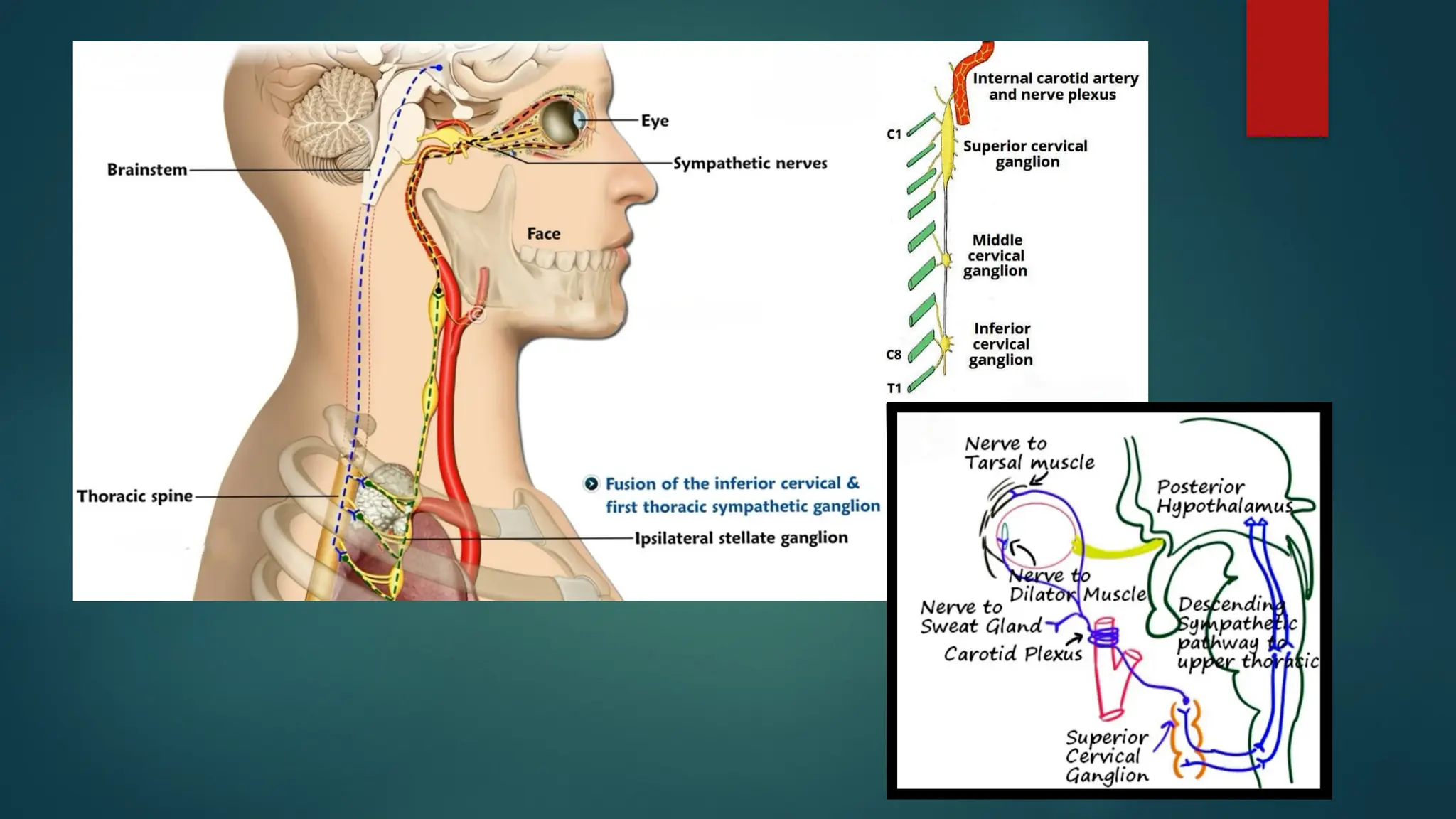 horners syndrome medicine and surgery ppt | PPTX