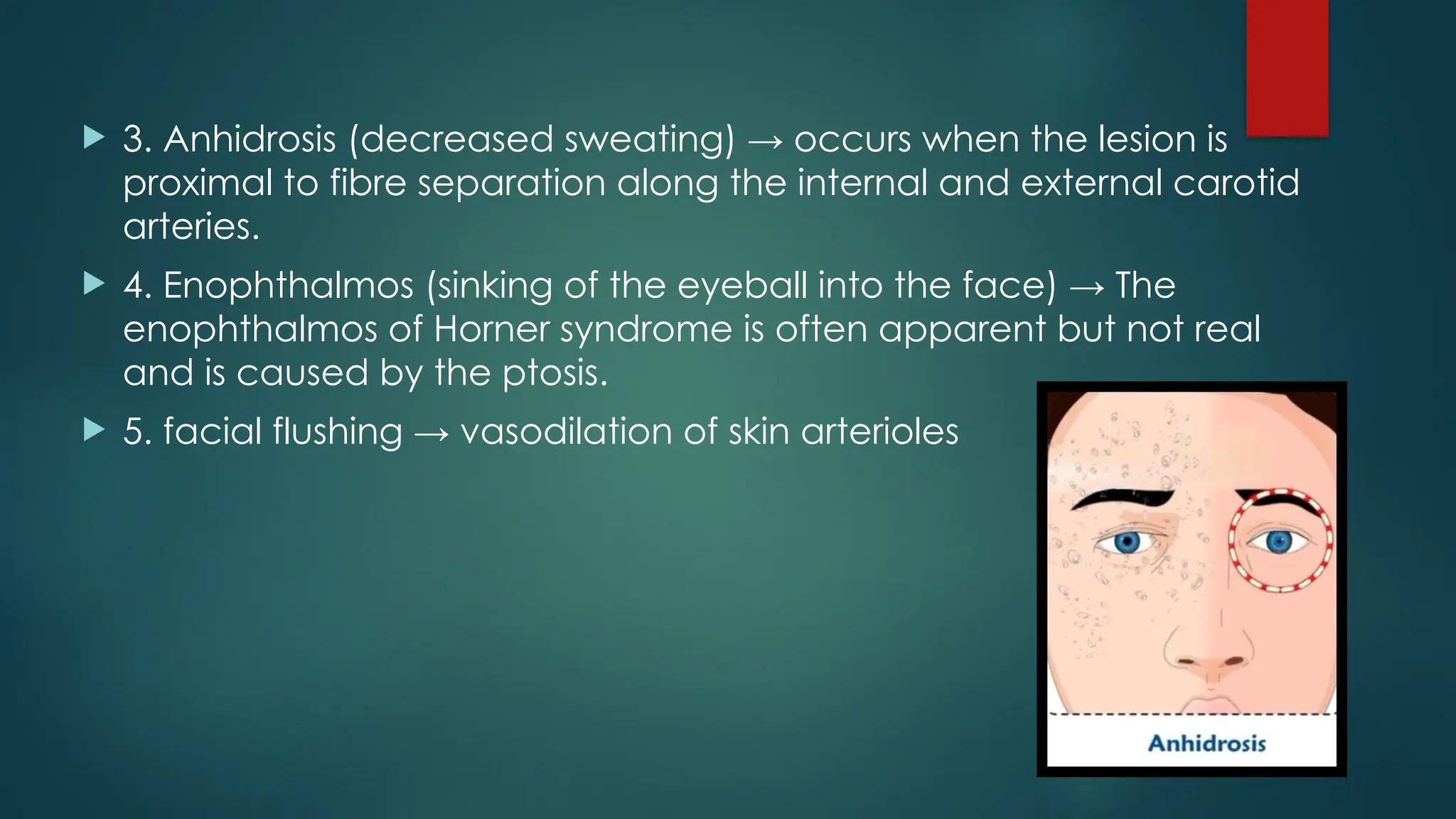 horners syndrome medicine and surgery ppt | PPTX