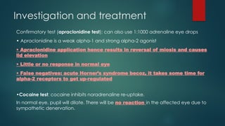 horners syndrome medicine and surgery ppt | PPTX