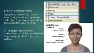 horners syndrome medicine and surgery ppt | PPTX