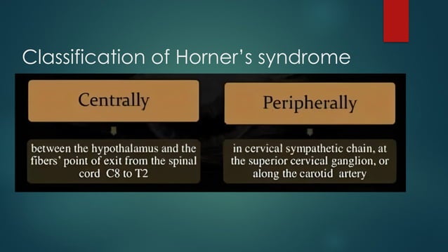 horners syndrome medicine and surgery ppt | PPTX