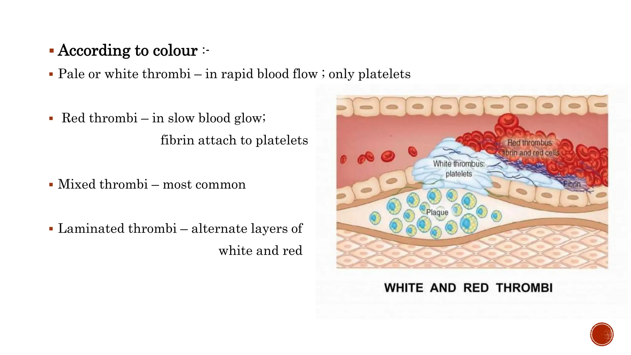 Akhil thrombosis ppt very effective ppt very veryppt.pptx