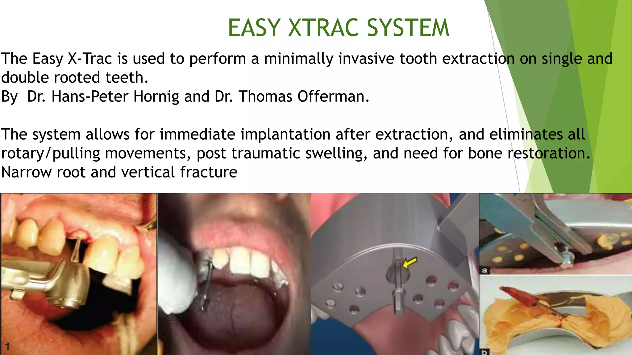 Recent Advances in Implanty Dentistry | PPTX