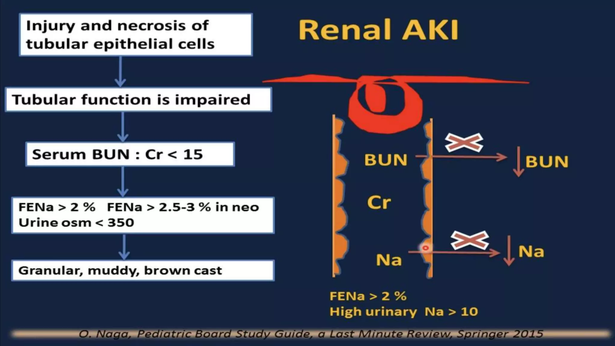 pediatric Acute Kidney Injury - AKI | PPTX