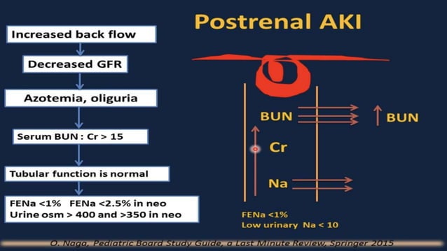 pediatric Acute Kidney Injury - AKI | PPTX | Blood Disorders | Diseases ...