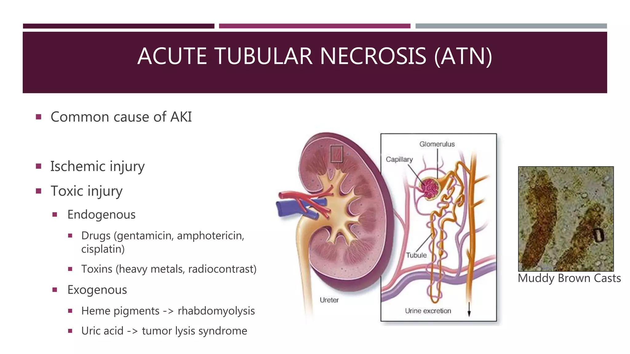 Pediatric Acute Kidney Injury.pptx