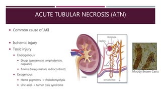 Pediatric Acute Kidney Injury.pptx | Blood Disorders | Diseases and ...
