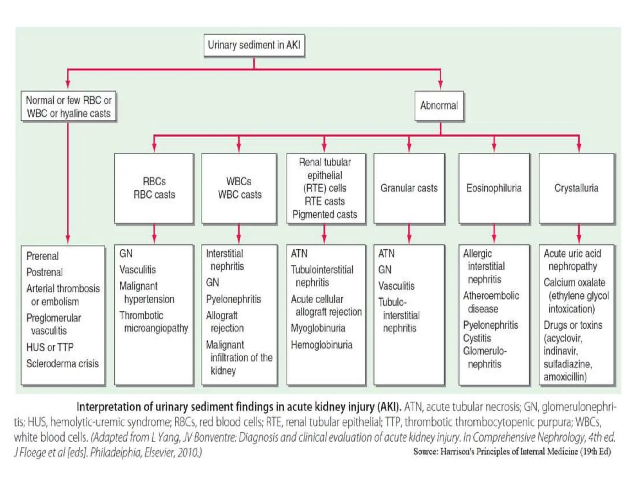 Acute Kidney Injury Etiology,Type and MANEGEMENT | PPTX