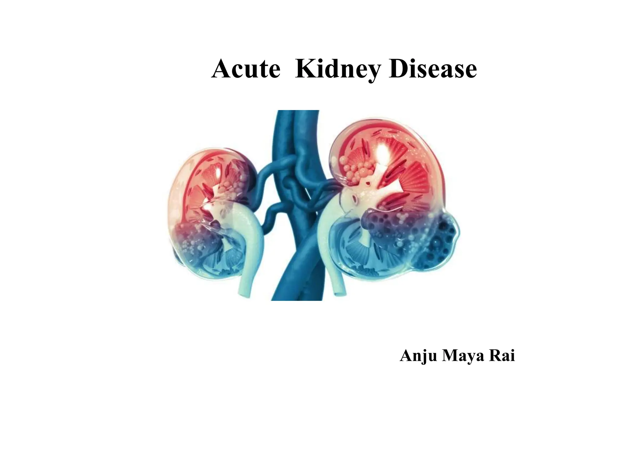 acute kidney disease /acute kidney injury | PPTX