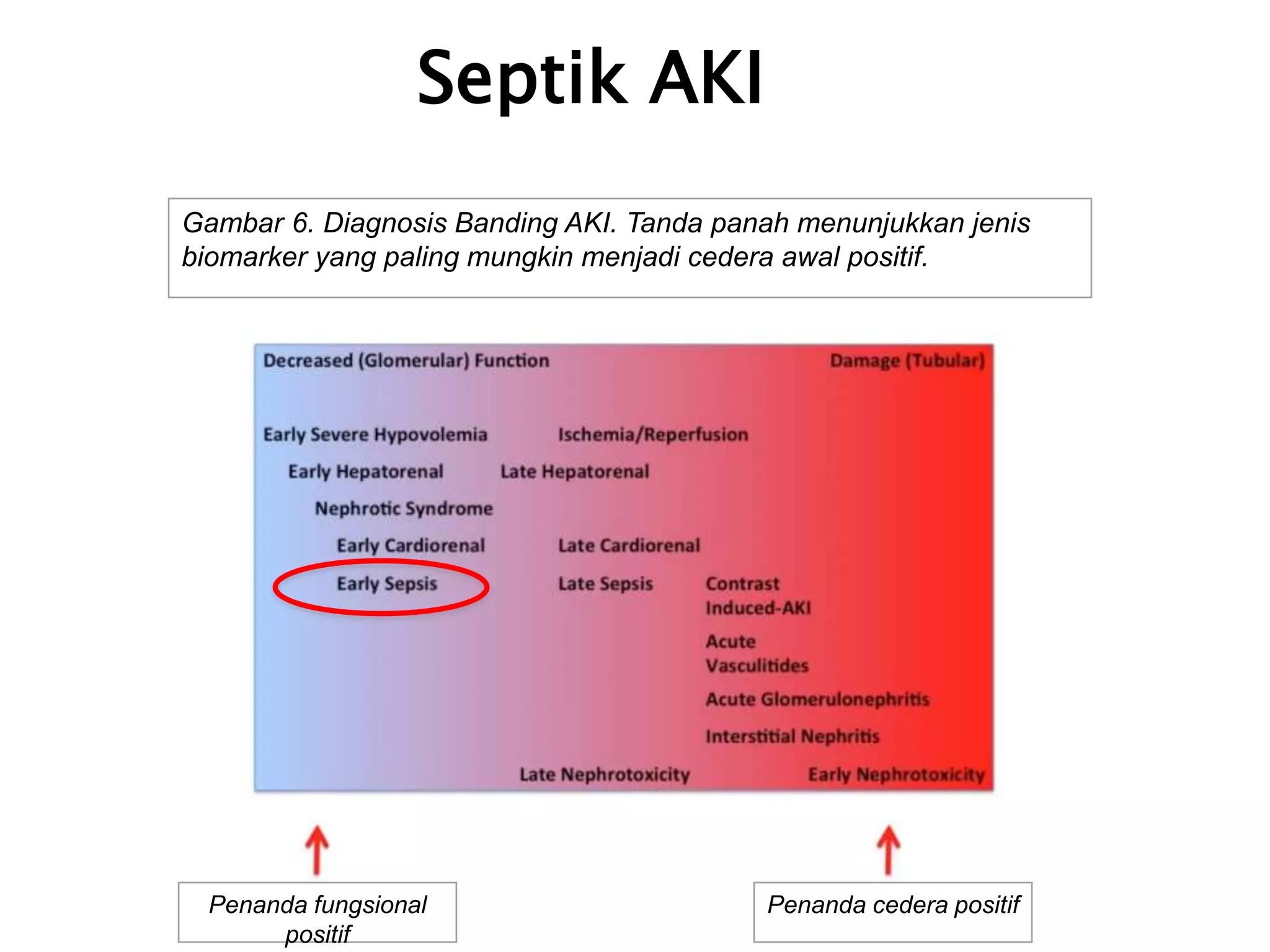 AKI A New term and Classification (Indonesia). diklat ppt.ppt