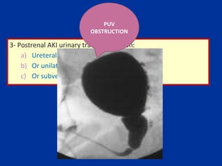 Acute kidney injury in children | PPT