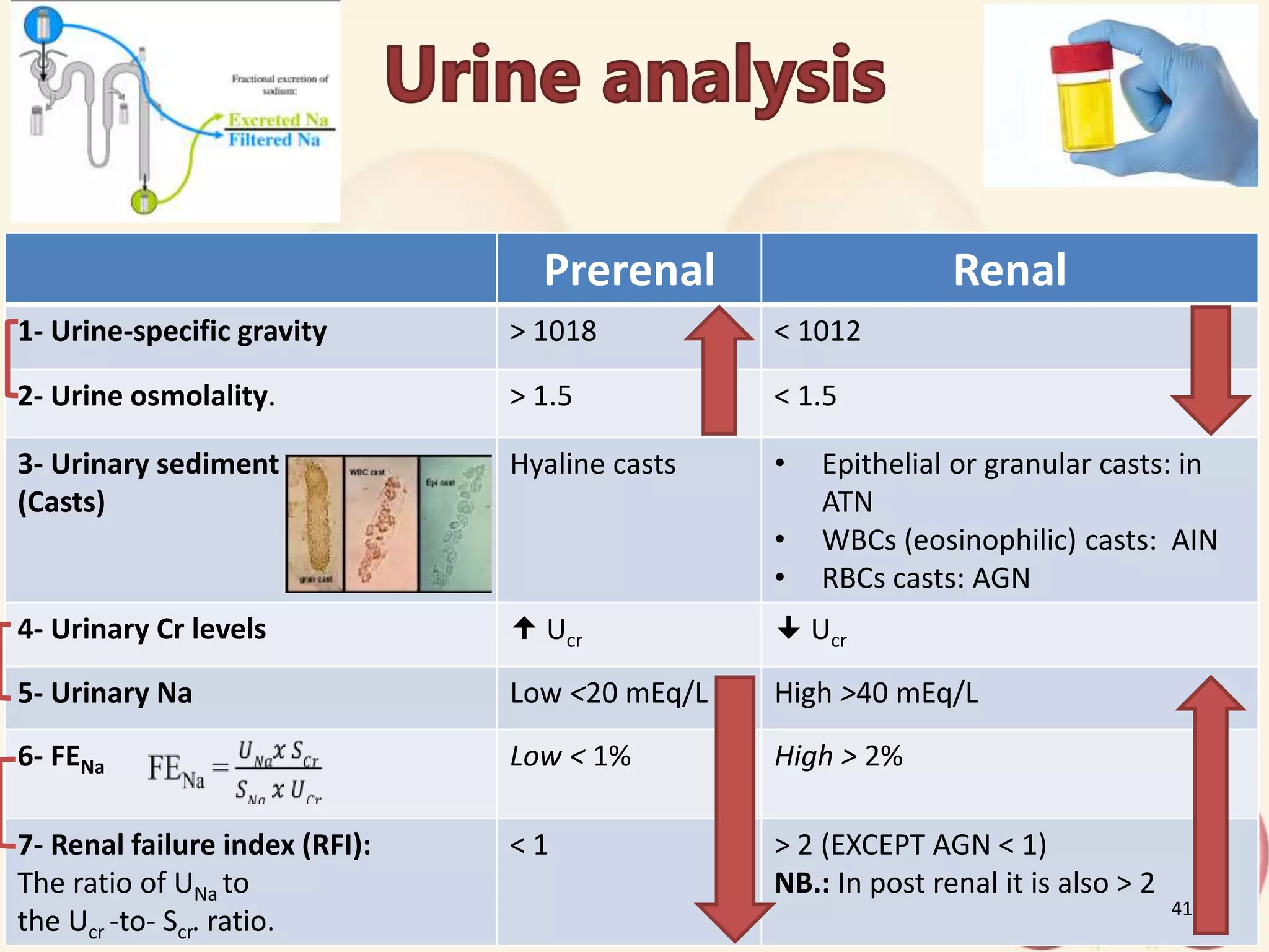 Aki lecture | PPTX