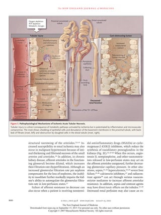 Aki normotensiva | PDF
