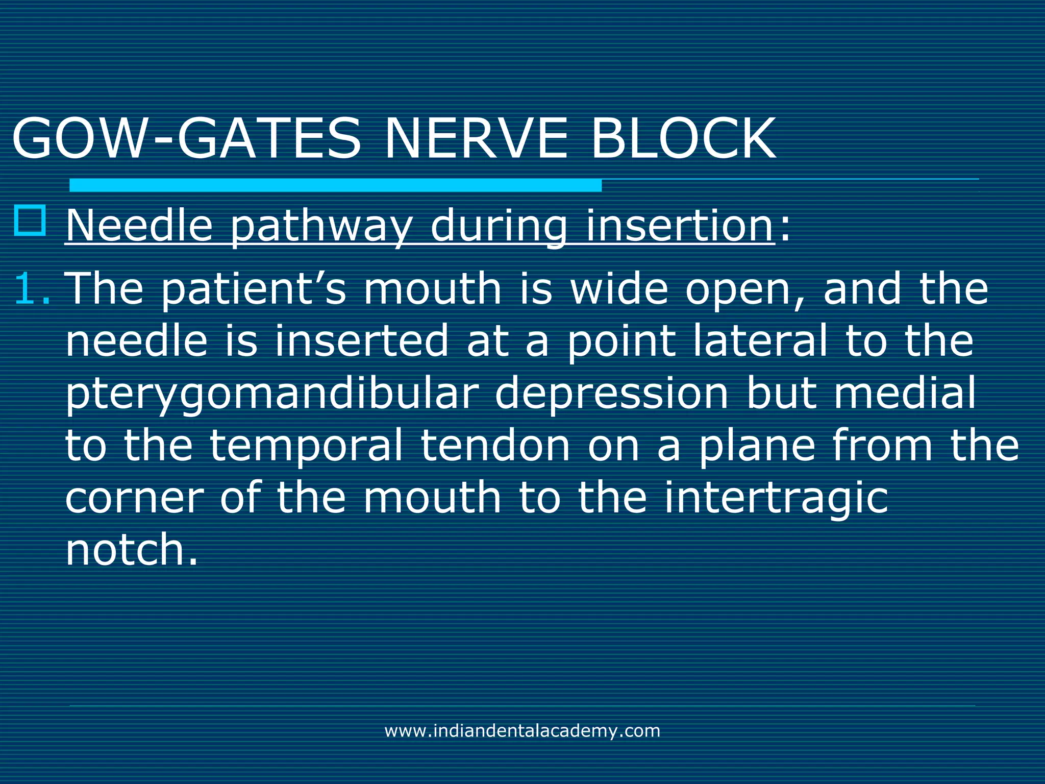 Akinosi & gow gates nerve blocks / prosthodontic courses | PPT