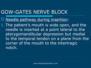Akinosi & gow gates nerve blocks / prosthodontic courses | PPT