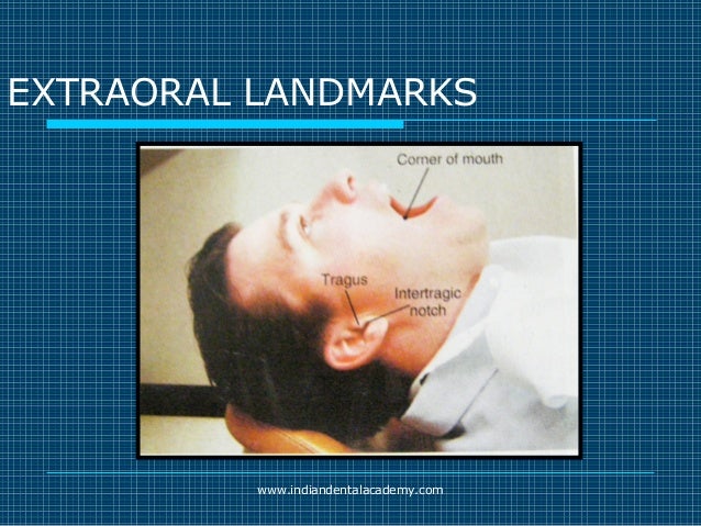Akinosi & gow gates nerve blocks / prosthodontic courses