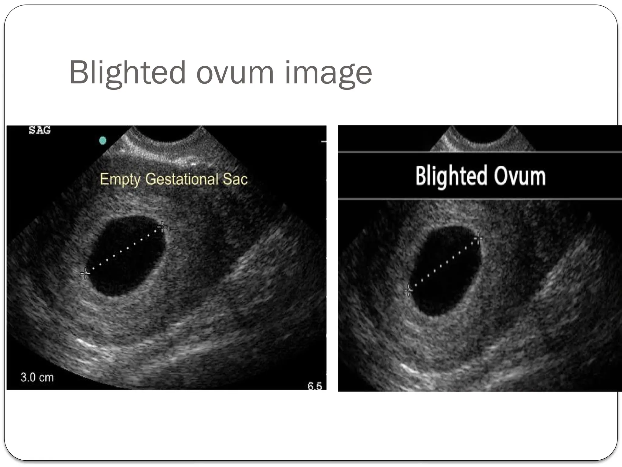 Akinroye blighted clinical posting presentations | PPTX